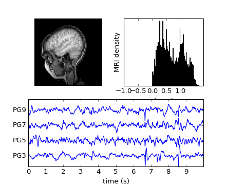 pylab_examples example code: mri_with_eeg.py — Matplotlib 1.3.1 documentation